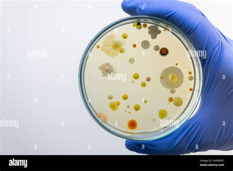 What Is Isolation Of Bacteria At Brayden Cooke Blog