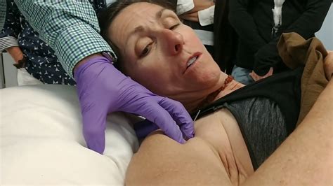 Orthopedic Trigger Point Acupuncture Dry Needling Chinese Medicine Deltoid YouTube