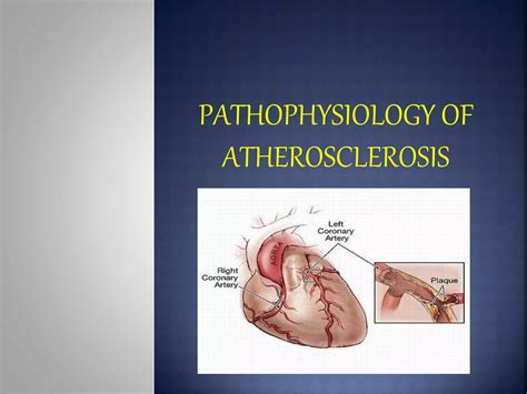 Atherosclerosis Pathophysiology Pptx