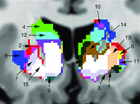 Enlarged View Of The Dorsal Striatum Divided Into 15 Functional