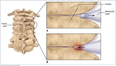 Joint Dysfunction Subluxation Misalignment Of The Cervical Spine