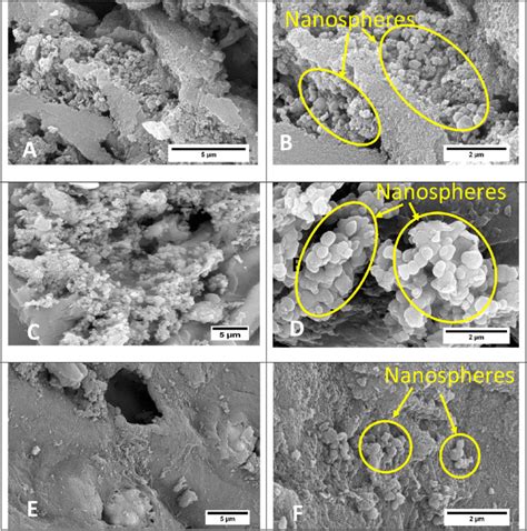 E Sem Illustration Of Nanocellulose Extracted From 3 Types Of Palm