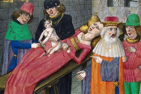 How Medieval Surgeons Shaped Sex And Gender Jstor Daily