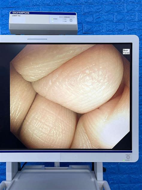 Used Olympus Scope Model  Hq290 For Sale In Manchester United