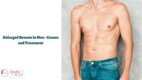 Enlarged Breasts In Men — Causes And Treatment By Beauty And The Cut