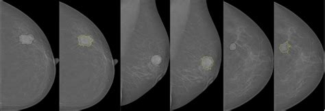 Xavier Beltran Urbano