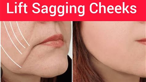 5 Minute Facial Workout To Lift Sagging Cheeks And Mouth Corners No