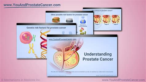 Slide Show Understanding Prostate Cancer