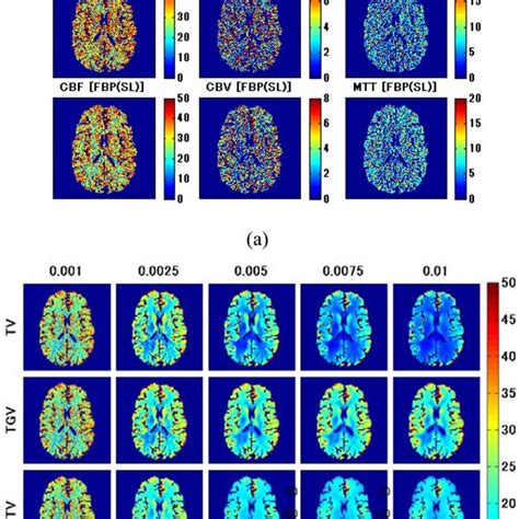 A Cbf Left Column Cbv Middle Column And Mtt Images Right