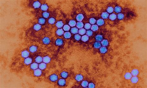 Polio Virus Under Microscope