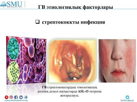 Геморрагиялық васкулит презентация онлайн