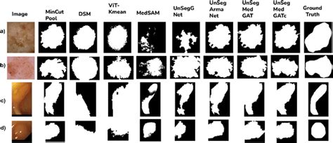 Unsegmedgat Unsupervised Medical Image Segmentation Using Graph