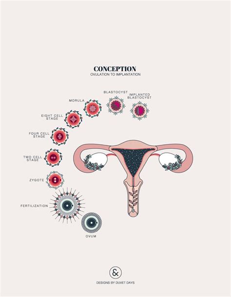 What Is Endometriosis Artofit