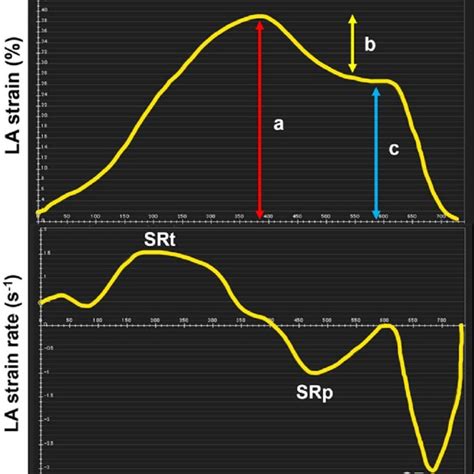 Quantification Of Left Atrial Strain And Strain Rate Left Atrial