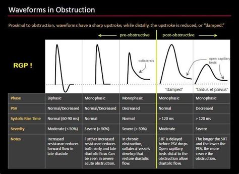 Dampened Art Line Waveform Liccomp2009