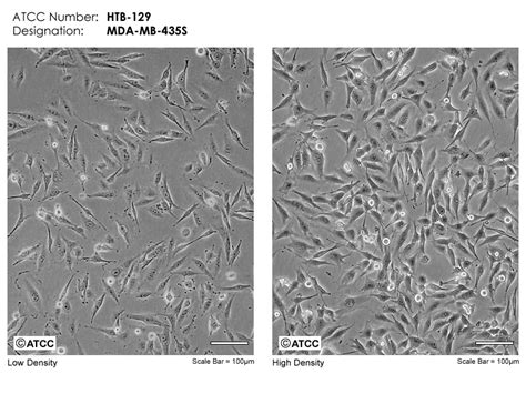 Mda Mb 435s细胞atcc Htb 129细胞 Mdamb435s人乳腺腺癌细胞株购买价格、培养基、培养条件、细胞图片、特征等基本信息生物风