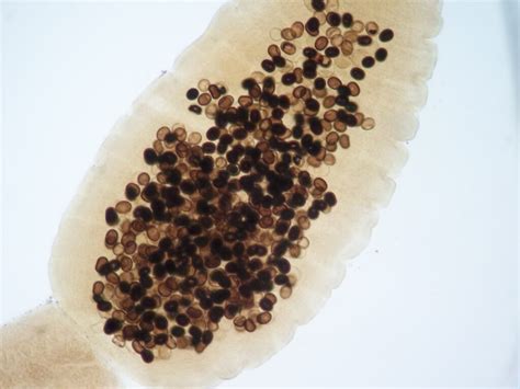 O Que é Equinococose Memoria Viva