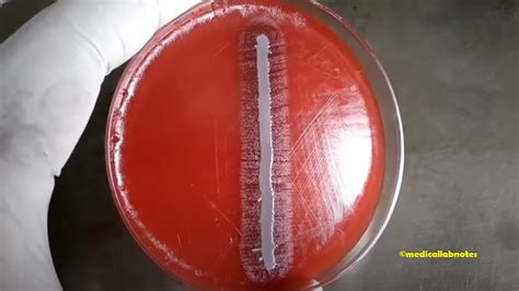 Haemophilus Influenzae Satelitismo Special Microbiology Practical