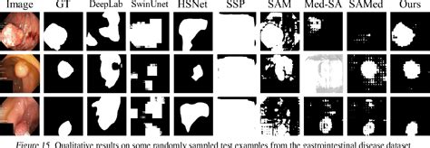 Figure 15 From Blo Sam Bi Level Optimization Based Overfitting Preventing Finetuning Of Sam