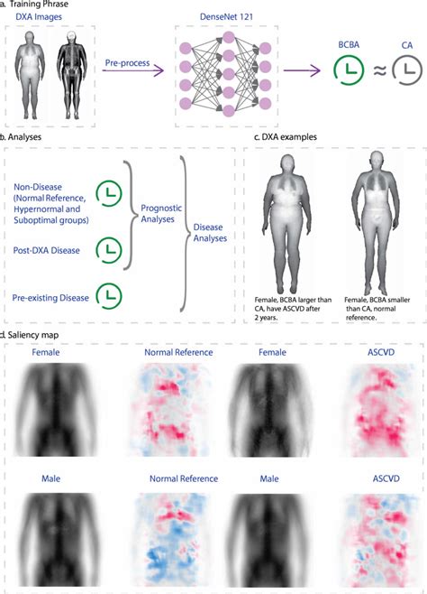 A Deep Learning Sex Specific Body Composition Ageing Biomarker Using Dual Energy X Ray