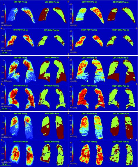 Sample Coronal Slices These Sample Slices Are Taken From One Study Download Scientific Diagram