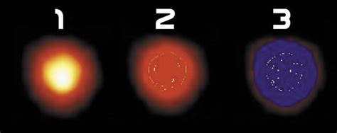 Fosfenos ¿qué Son La Luz Y El Fosfenismo