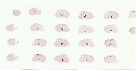 Pitx2 Rna In Situ Gene Expression Assay Gxd