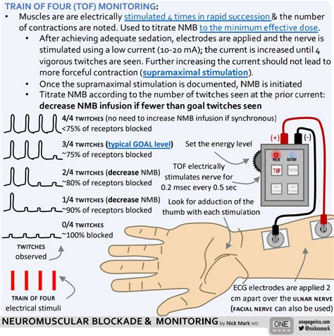 Train Of Four Tof Monitoring Neuromuscular Blockade Used Grepmed