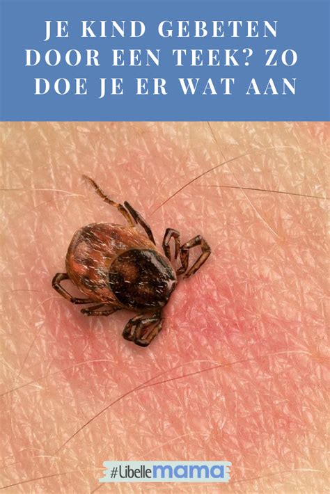 Tekenbeet Bij Je Kind Enkele Tips Artofit