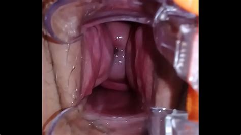 Gozando Com O Espéculo Arreganhando A Buceta Cumming With A Speculum