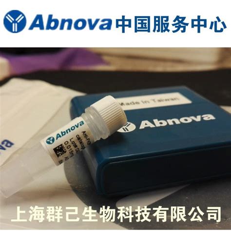 ZNF223 小鼠单克隆抗体 杂交瘤 价格 品牌 Abnova 丁香通官网