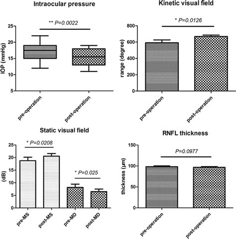 A Comparison Between Preoperative And Postoperative Iop Kinetic And