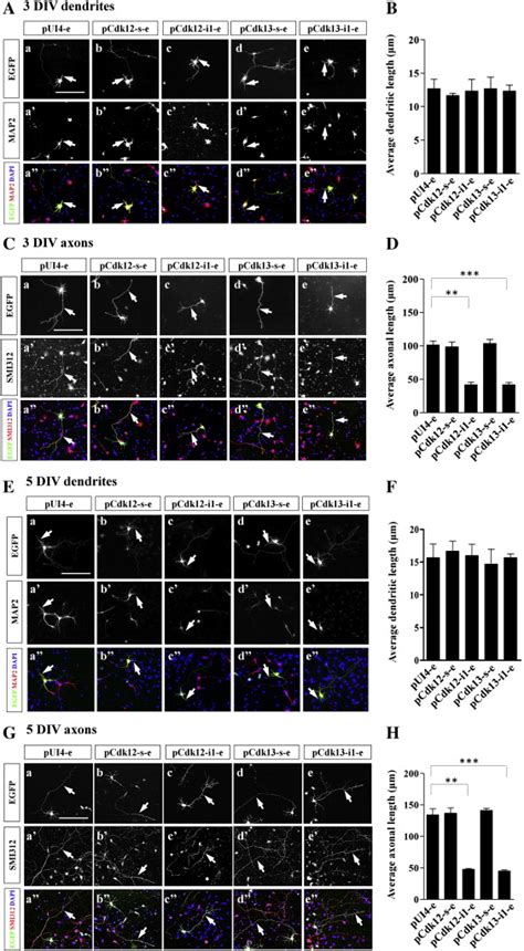 Cdk12 And Cdk13 Enhance Axonal Elongation In Primary Cultured Cortical Download Scientific