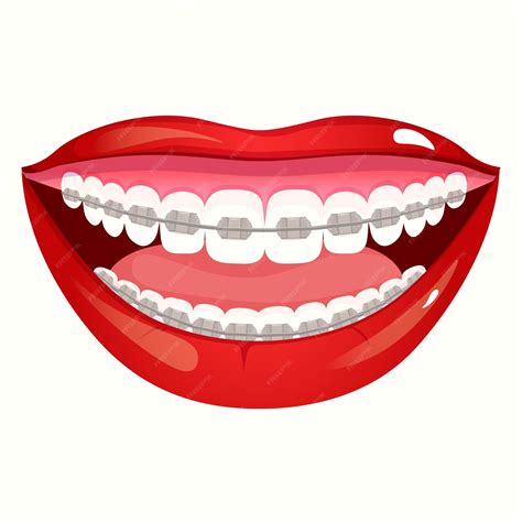 Premium Vector Girl Red Lips Smile With Teeth With Orthodontic Braces