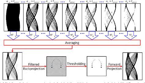 Figure 1 From Metal Artifact Reduction Based On Multi Level Sinogram Segmentation And