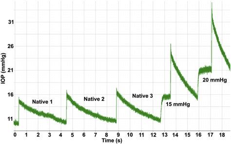 Screen Capture Of 13 Minutes Of Iop Data Measured During A Typical