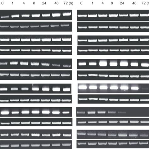 Reverse Transcriptase Polymerase Chain Reaction Rt Pcr Analysis For Download Scientific