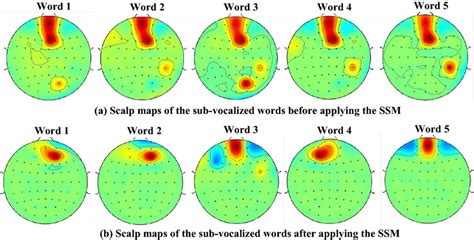 Scalp Topographical Presentation Of The Brain Activity Recorded From