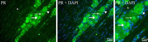 Progesterone Distribution In The Trigeminal System And Its Role To