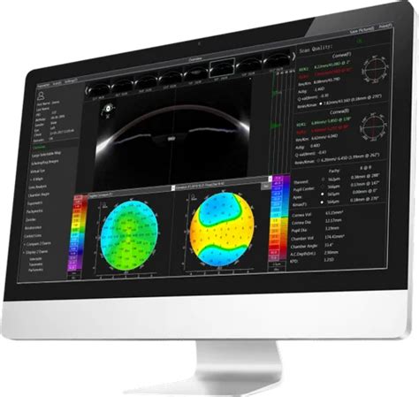 Scansys Anterior Segment Analyser At Rs 2400000 Chennai Id 2850544160762