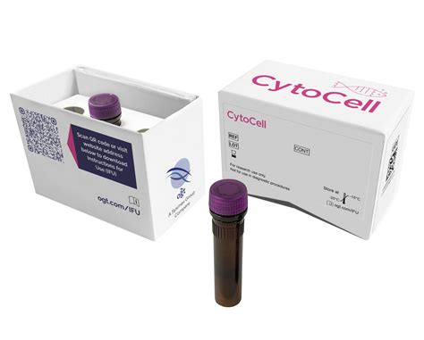 Cytocell Sry Fish Probe