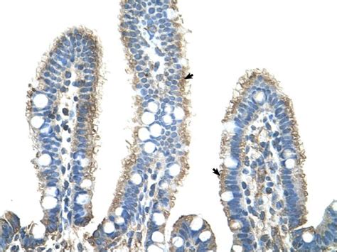 Anti Apcs Serum Amyloid P Sap Antibody Rabbit Anti Human Fitc Lsbio