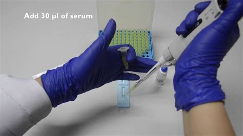 Typhidot Rapid Igm Test Instruction Video Youtube