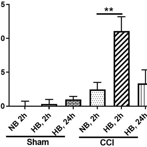 Hypobaria Exposure Enhances Plasma Homocysteine Elimination A A