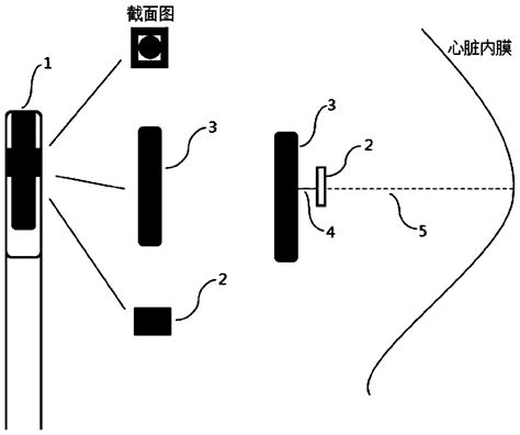 A Three Dimensional Cardiac Mapping System And Method Based On Ultrasonic Ranging Eureka Patsnap
