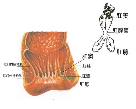 总感觉大便排不干净？有一种或是癌症预兆肛门