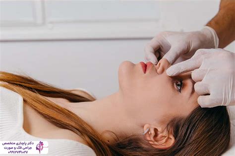 جراحی بینی شکسته در تهران درمان و عمل شکستگی بینی دکتر حمید پاچناری