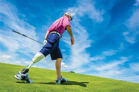 Prosthetic Limb Alignment In Texas Leaps Into 21st Century