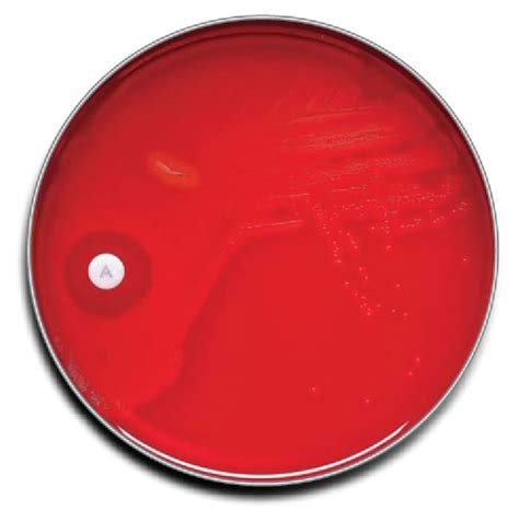 Bd Bbl Prepared Plated Media Group A Selective Strep Agar With 5