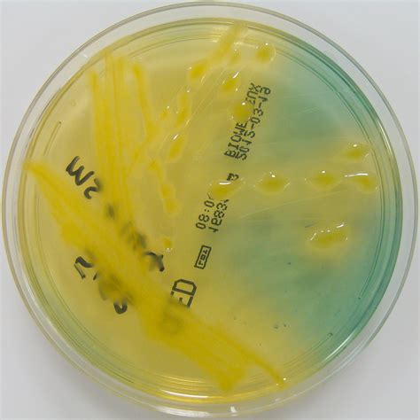 Flickriver Nathan Readings Photos Tagged With Uti